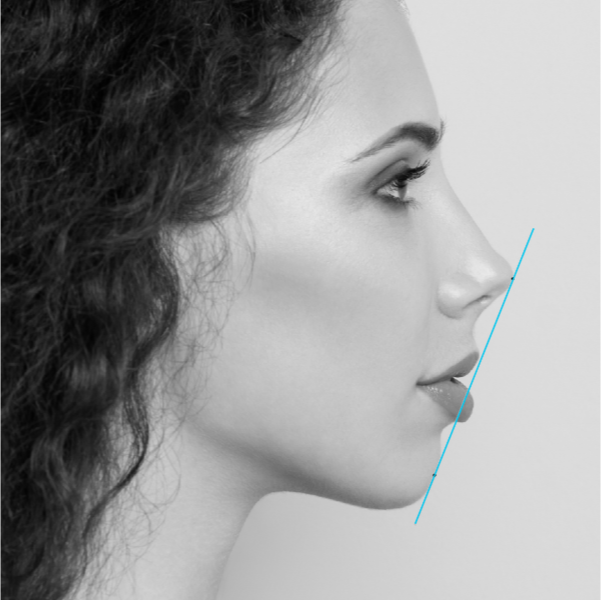 Dentscape